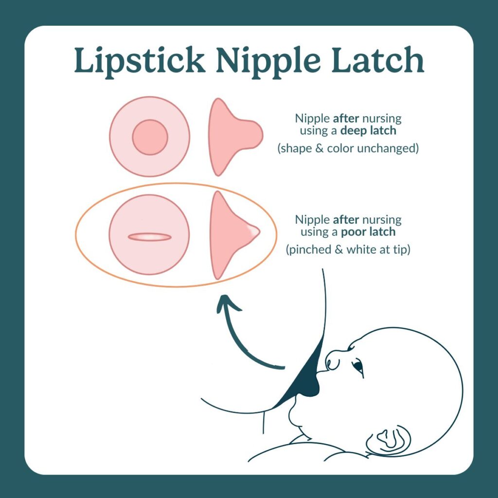 lipstick nipple latch - Breastfeeding Glossary by The Lactation Collection